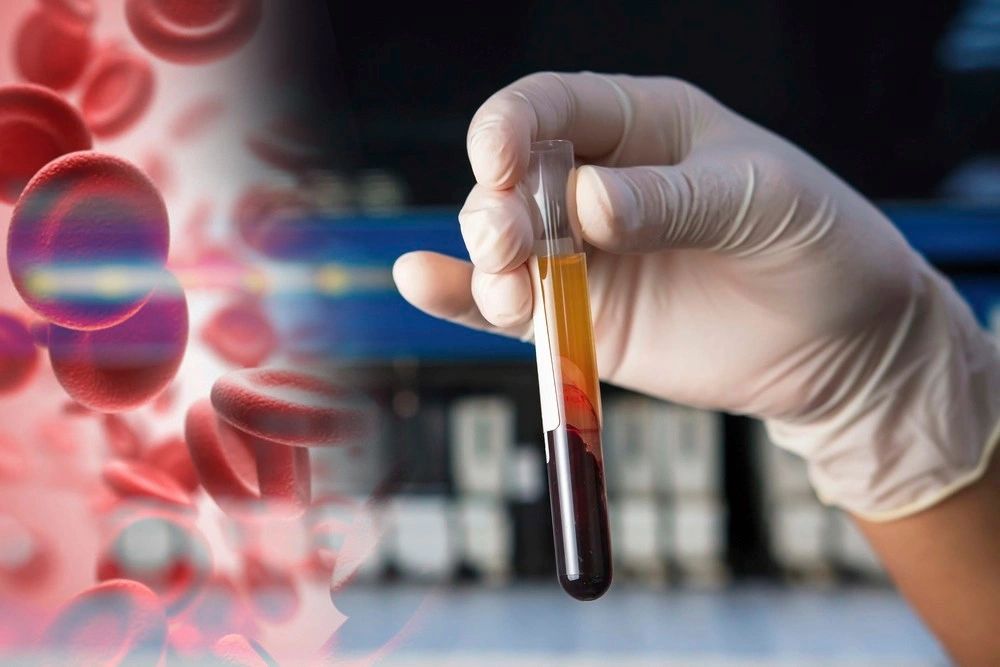 Cell Therapy Tools - Cell Therapy and Diagnostic, Tools and Reagents