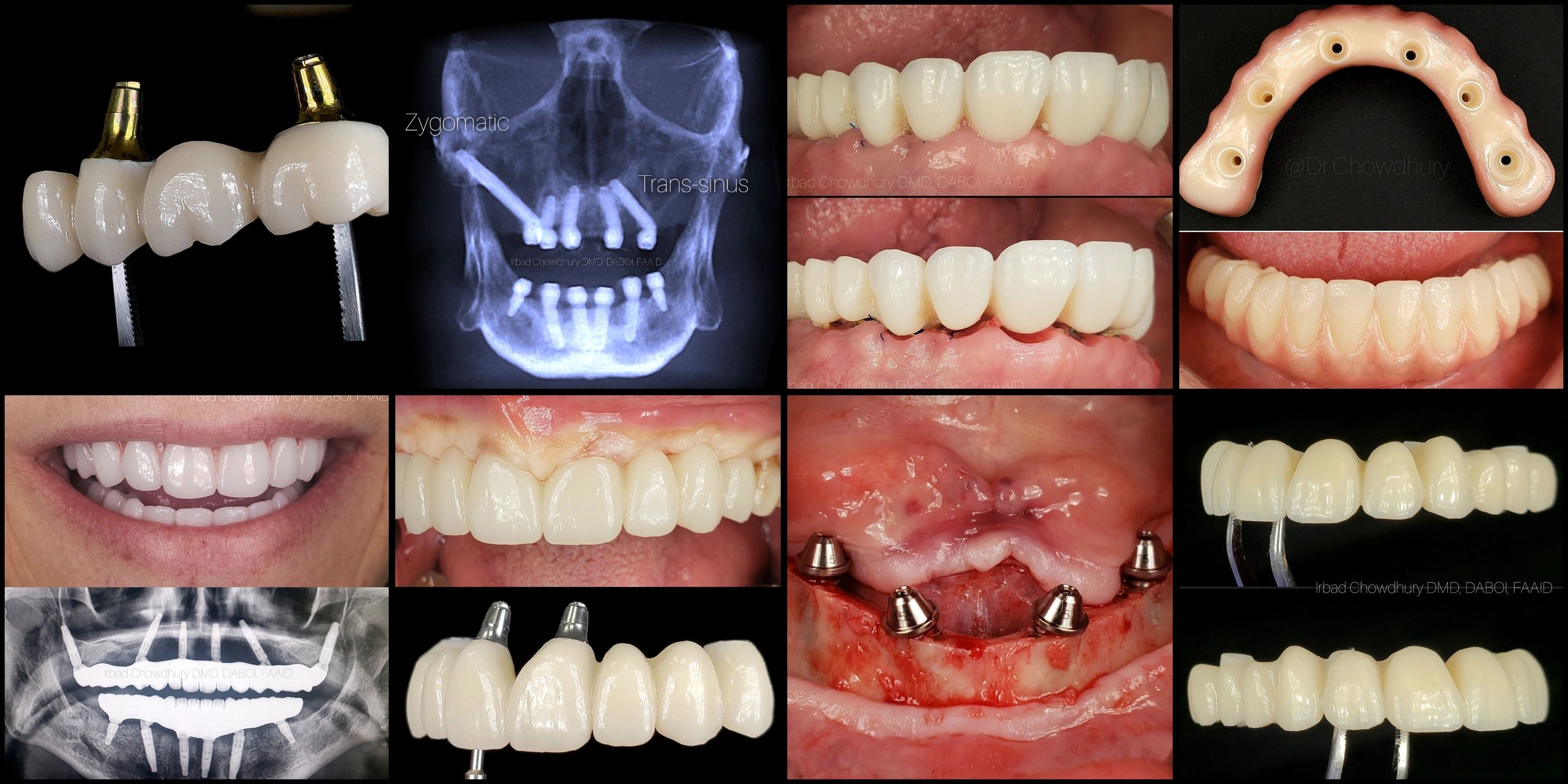 Oral Implantology Institute
