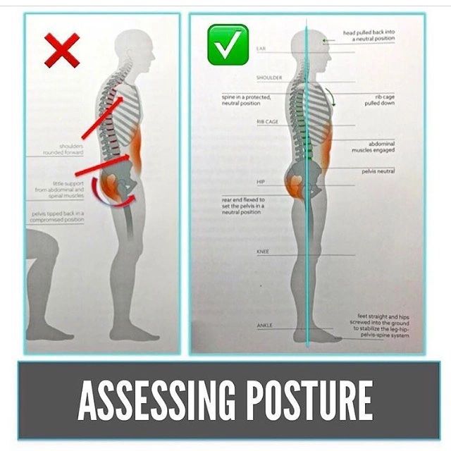 TIME FOR A POSTURE CHECK