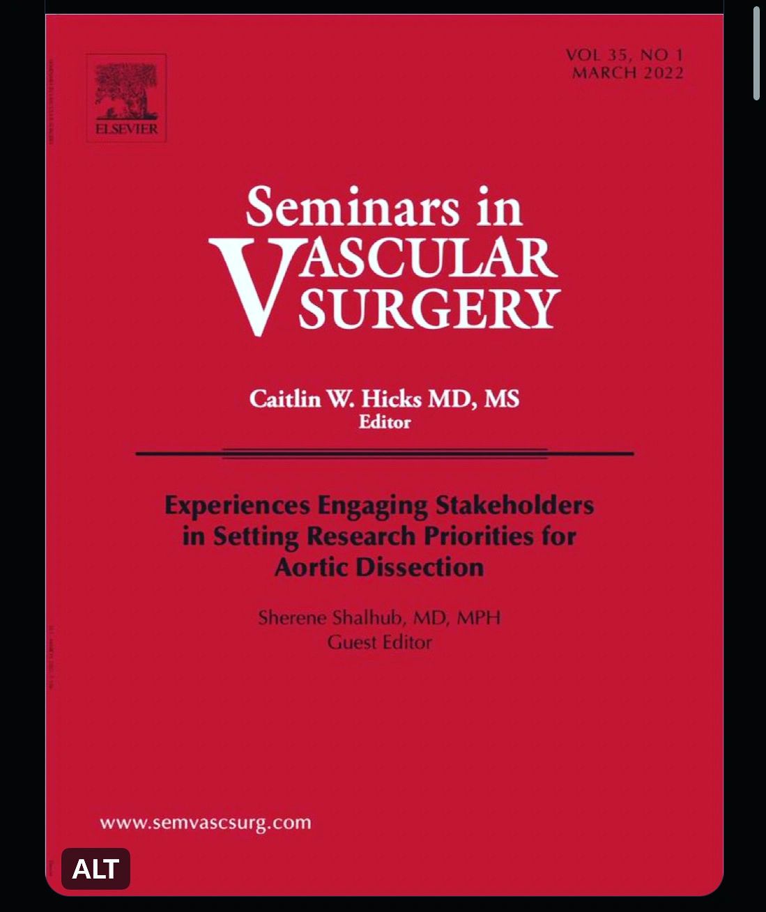 Aortic Dissection Review in Seminars of Vascular Surgery