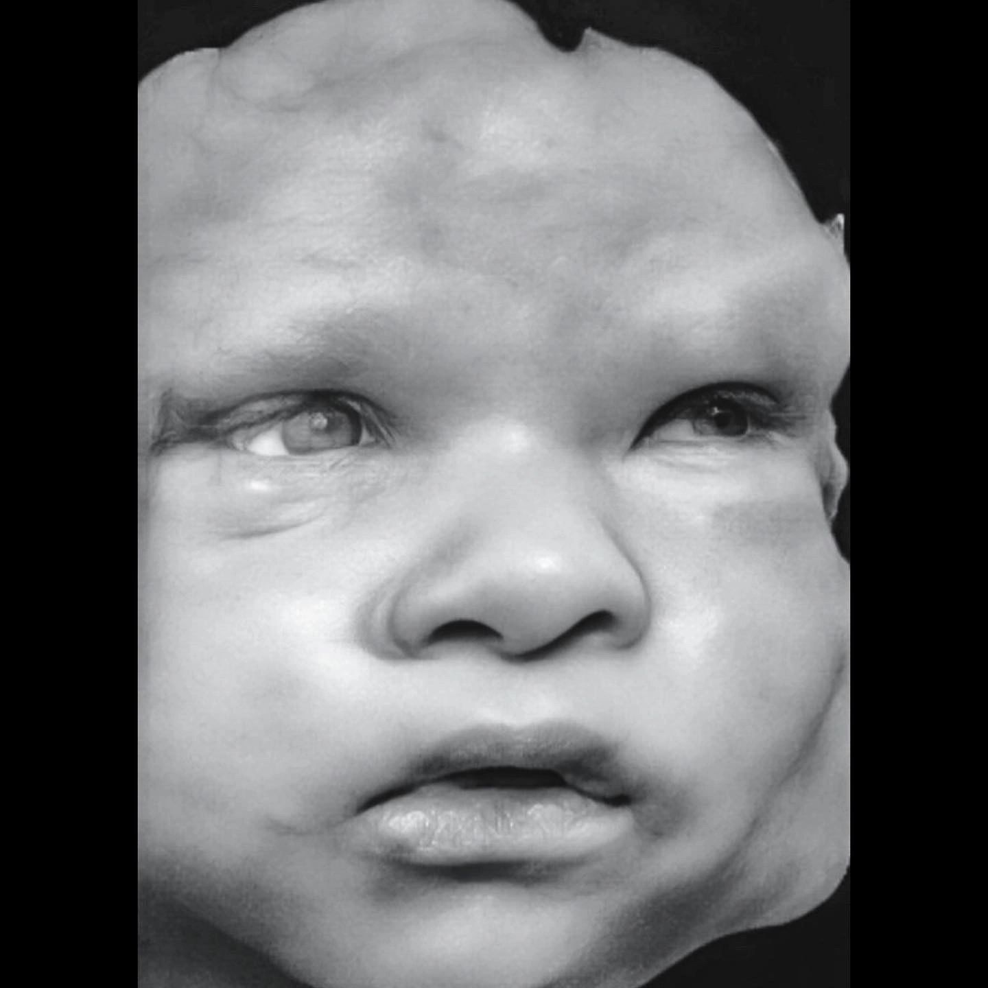 Peek-A-Boo Baby - 3d/4d Ultrasound, Imaging