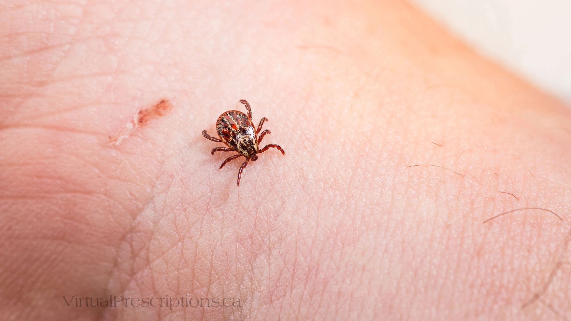 A Comprehensive Guide to Tick Prevention and Identification