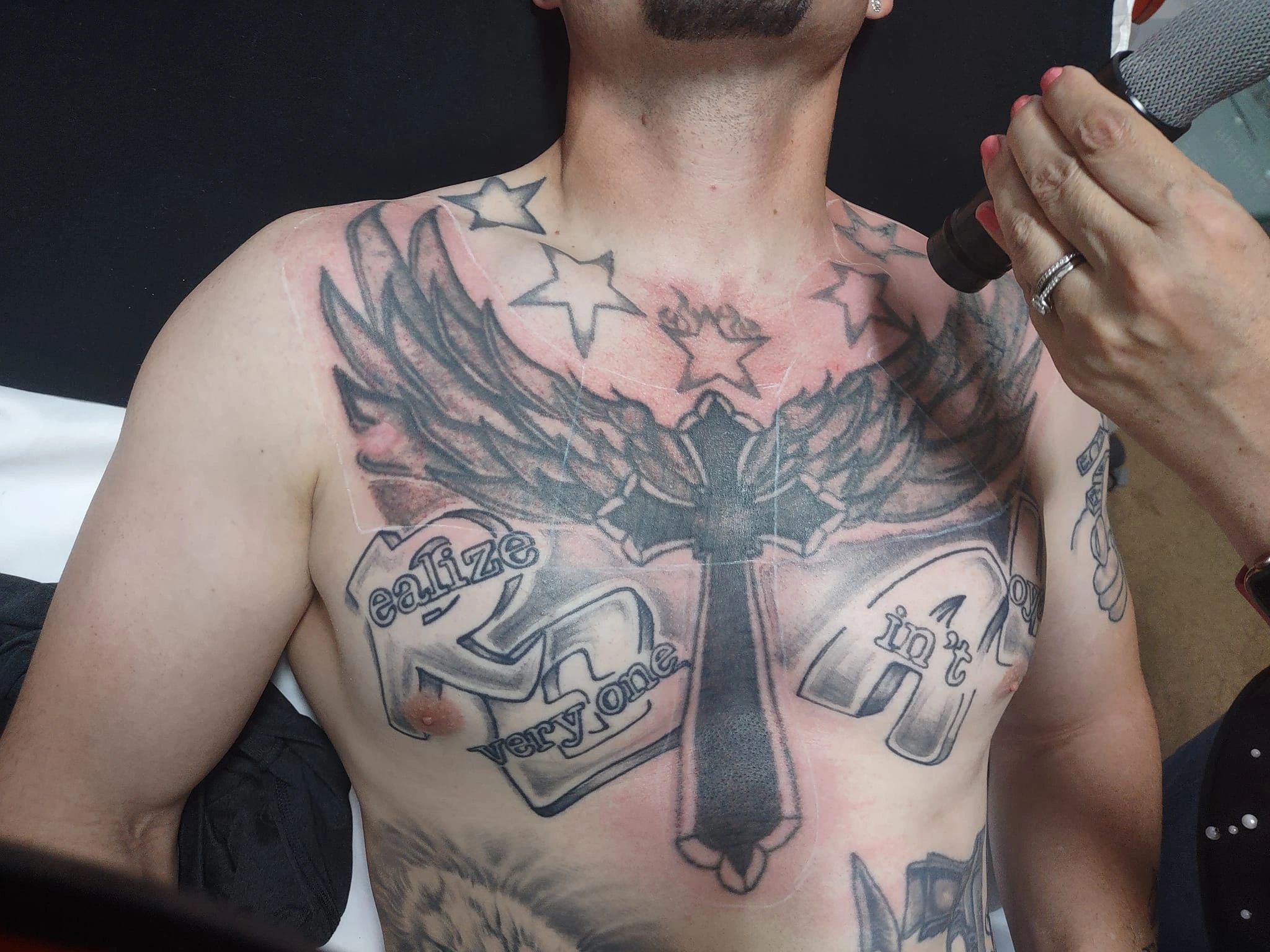 Complete Tattoo Removal Service