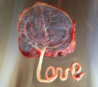 Placenta Encapsulation