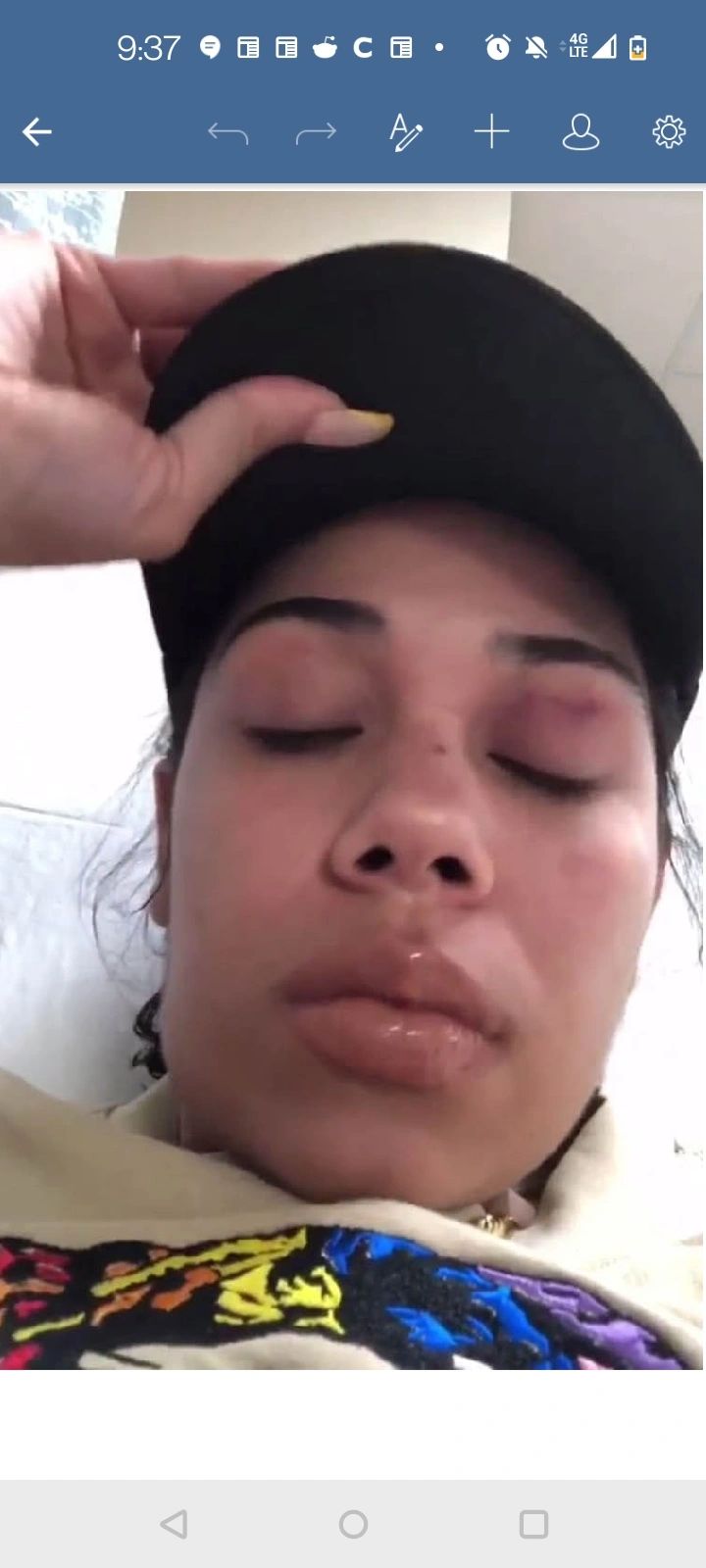 Tekashi 69 Baby Momma Sara Molina Leaks Photos After He Raped Her