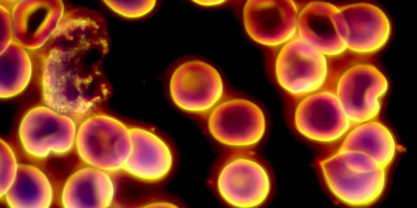 Live Blood Cell Analysis