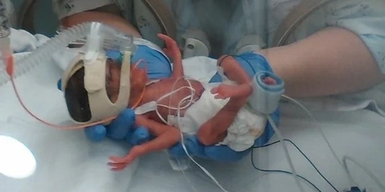 NICU Stories