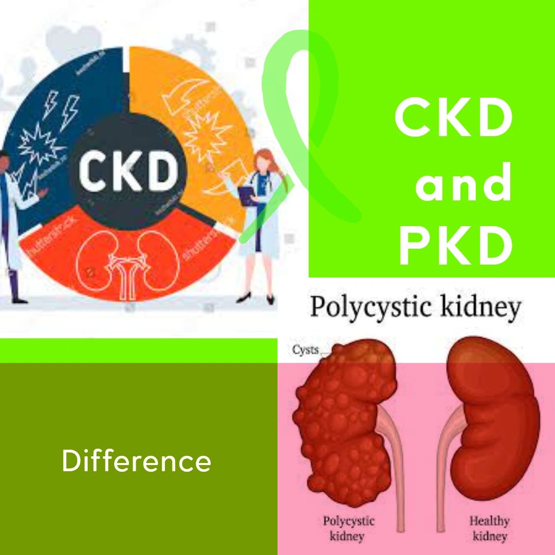 Understanding the Differences Between CKD and PKD