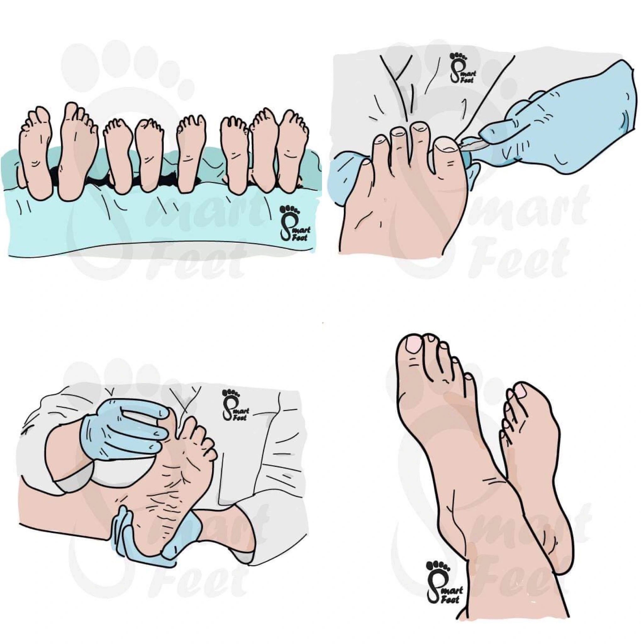 New Illustrations for Smart-Feet