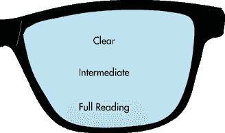 MYOPIA CONTROL | South Barrie Eye Clinic