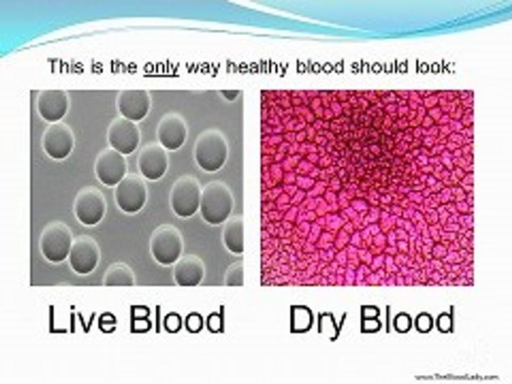 Blood Health | AAAH Water and Health, LLC Blood Health | AAAH Water and Health, LLC