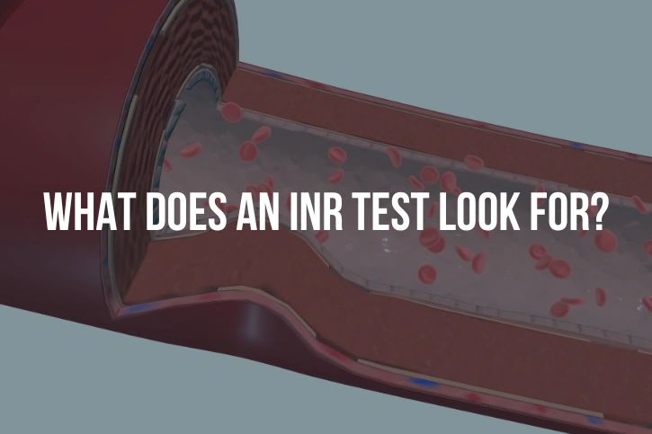 What does an INR test look for?