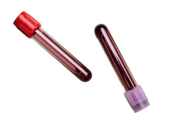 FOMOND PANEL (CMP/LIPID/CBC)