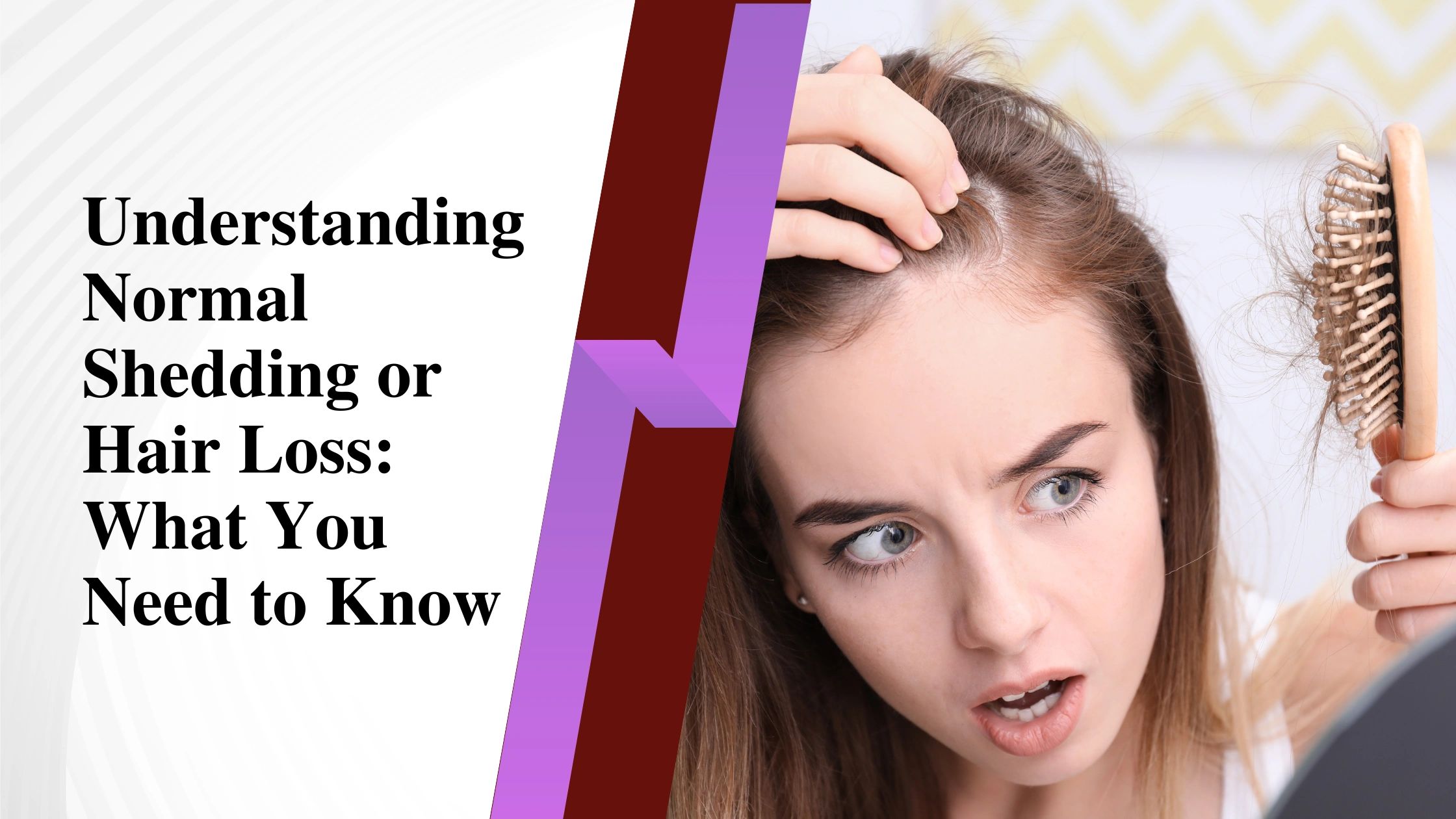 Normal Shedding or Hair Loss: What You Need to Know