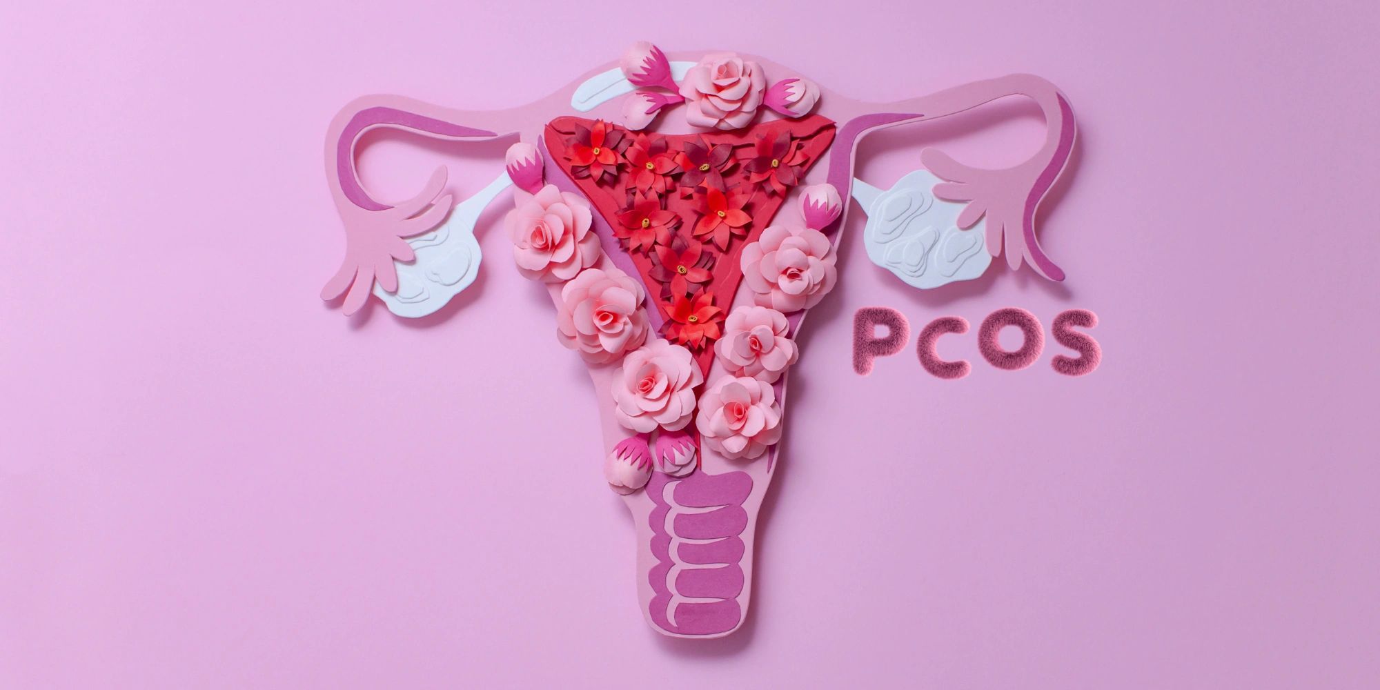 Understanding PCOS and How Laser Hair Removal Can Help