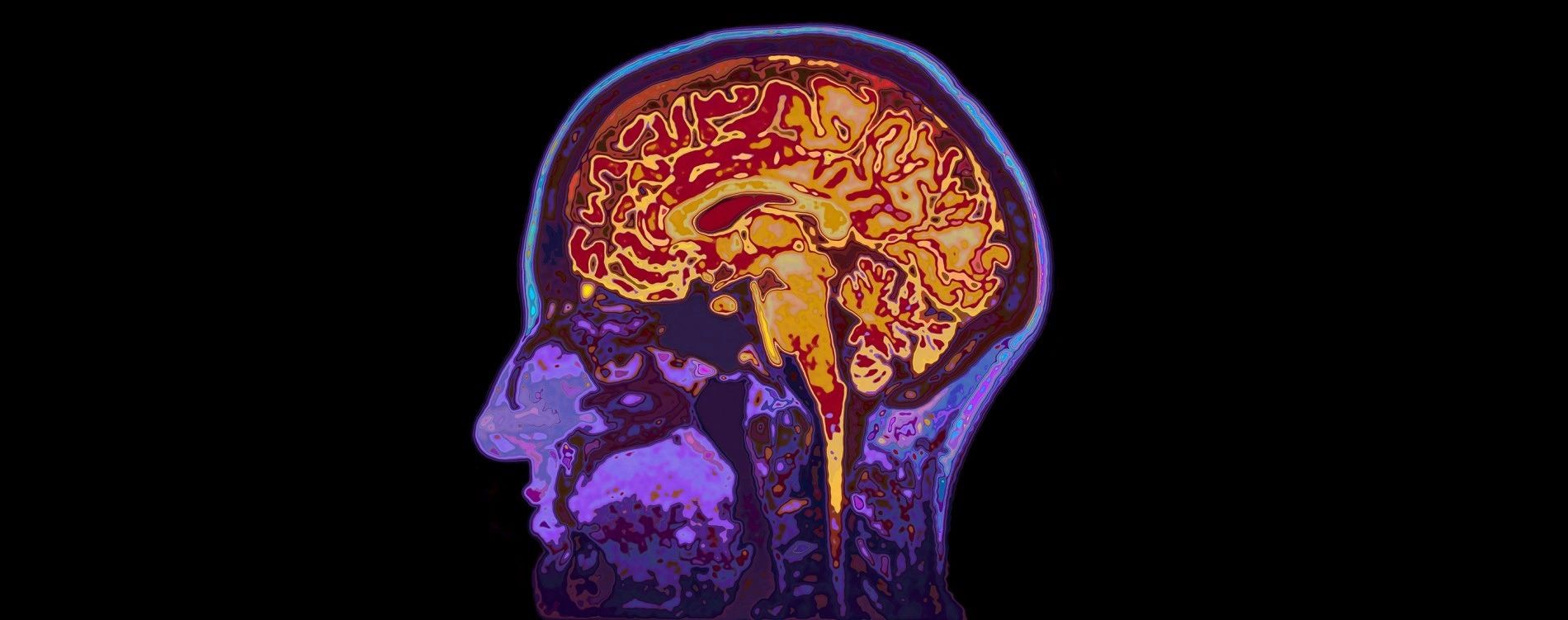 What the Heck is the Big Deal with Inflammation?