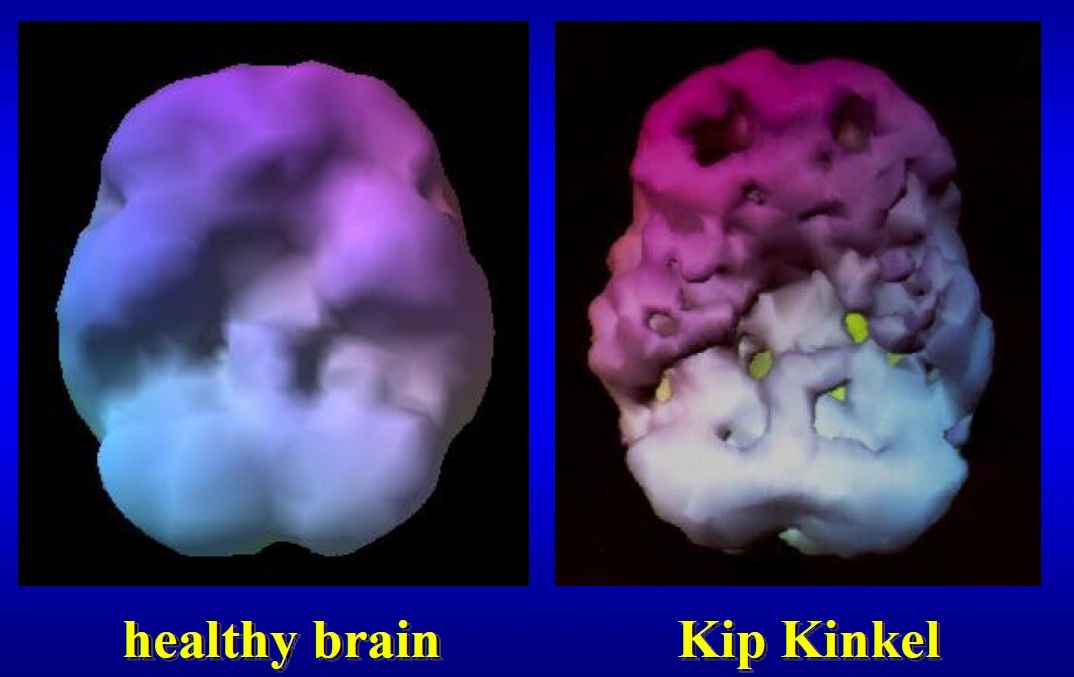 Is the Root of Gun Violence in the Brain?