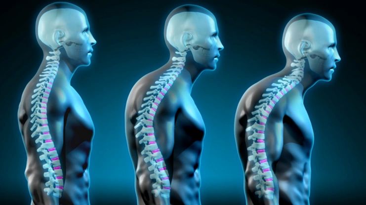 Better Posture for a Healthier Brain