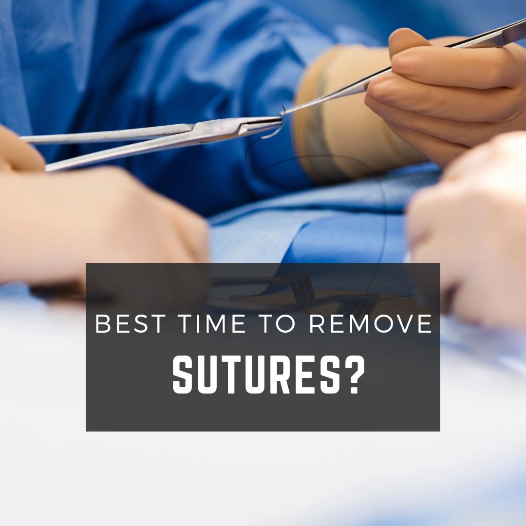 When is the best time for suture removal after surgery?