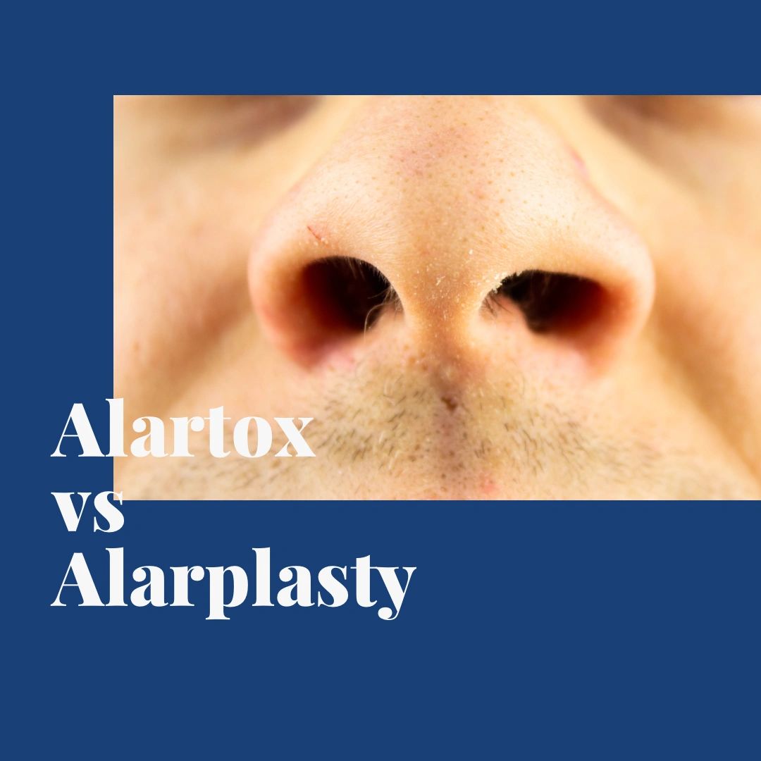 Alartox vs Alarplasty