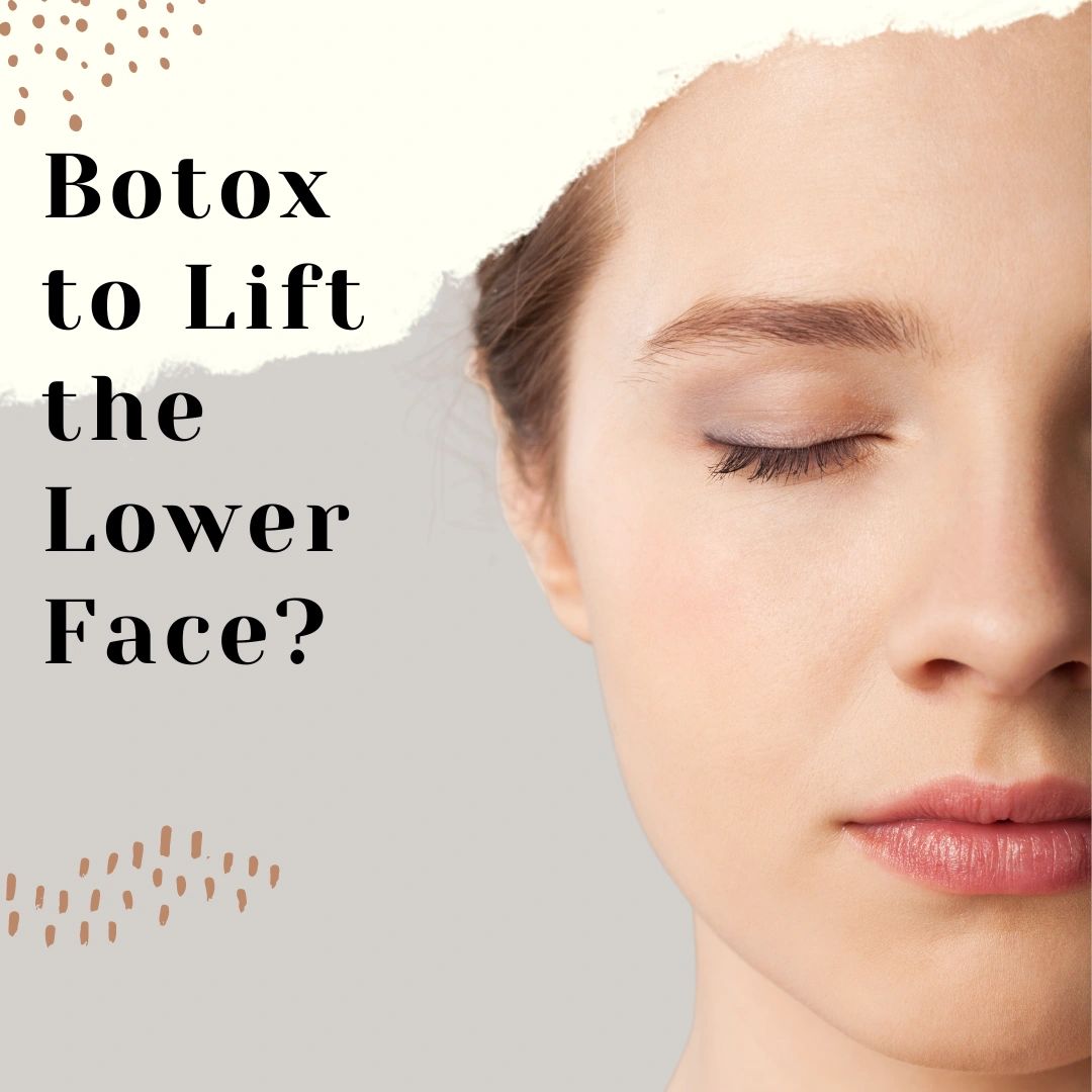Can botox be used for a non surgical face lift?