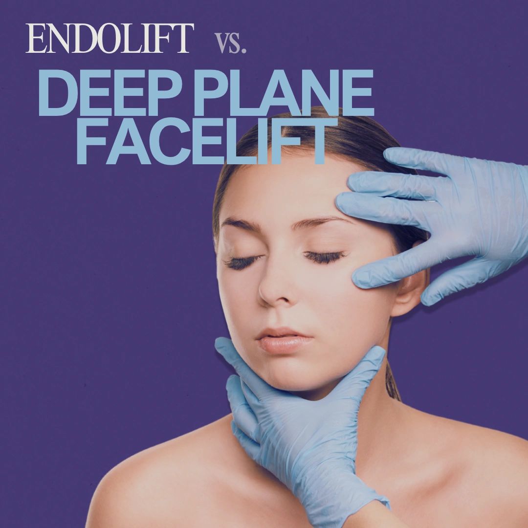 Endolift vs Deep Plane Facelift