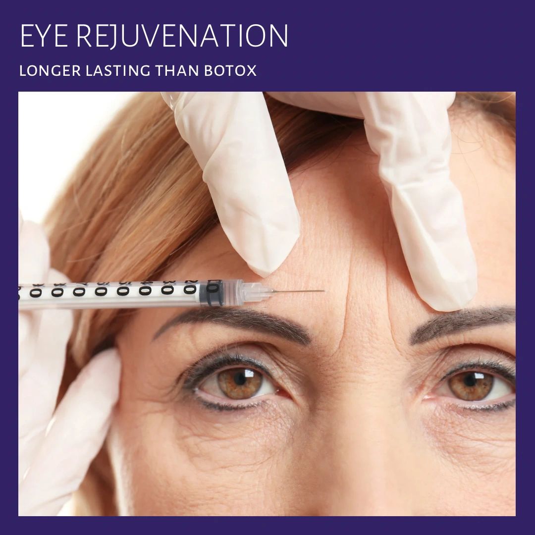 Eye rejuvenation procedures longer lasting than botox