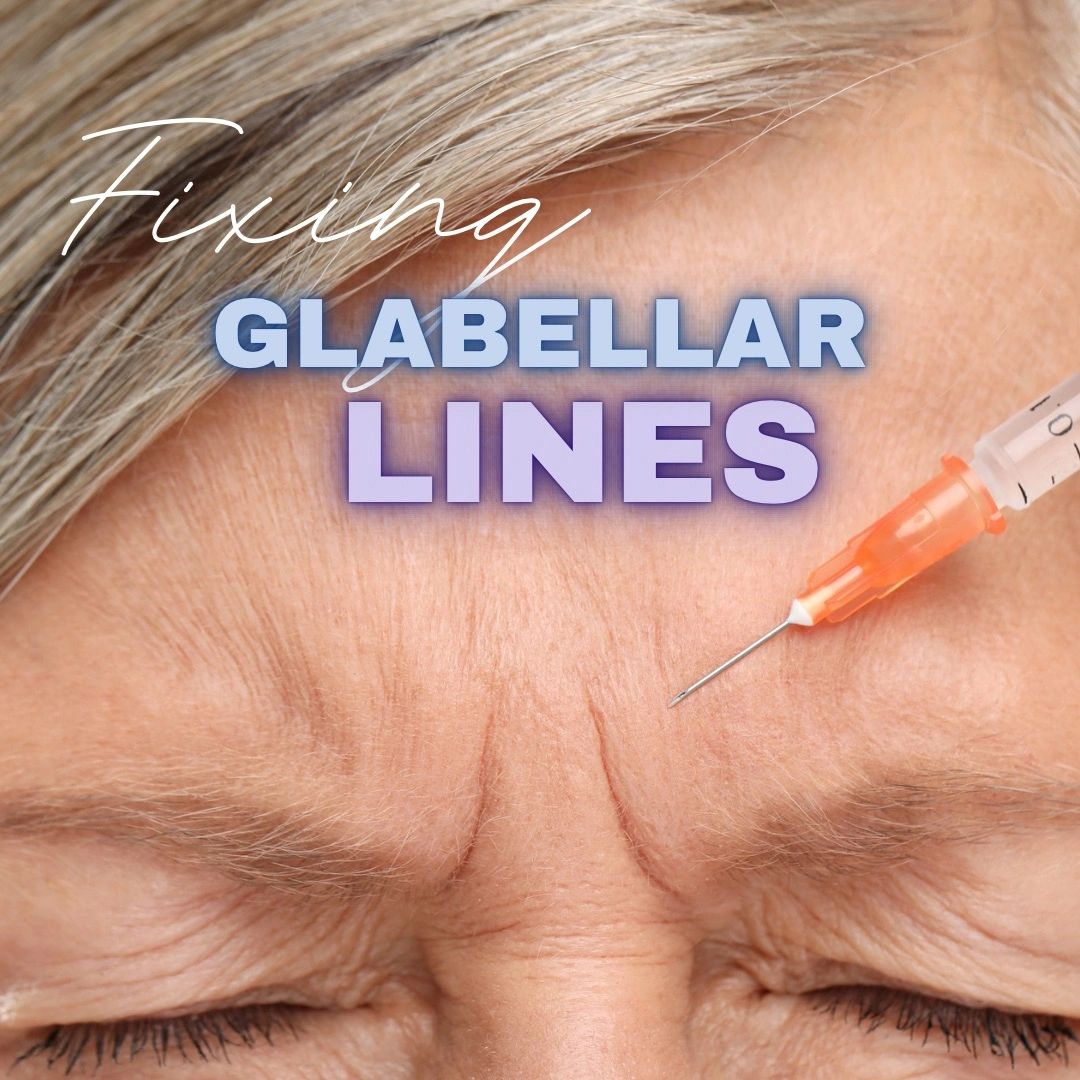 How to remove Number 11 forehead wrinkles?