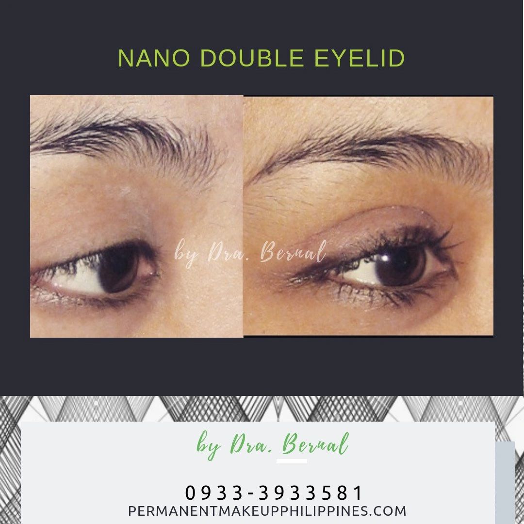 Nano Double Eyelid for Monolid Eyes
