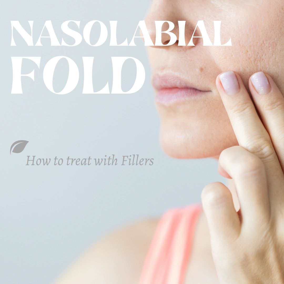 How to treat deep Nasolabial Folds with Filler Injection