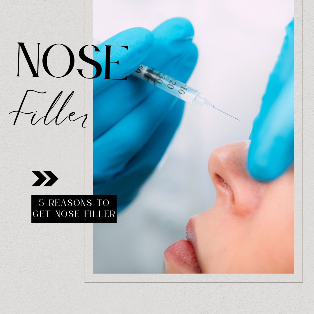 5 Reasons to get a Nose Filler