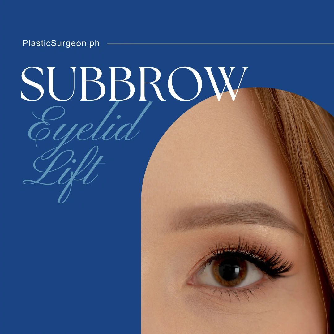 Sub-brow Eyelid Lift for Hooded Eyes