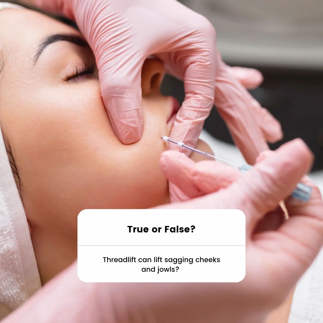 Does Thread Lift work on sagging face?