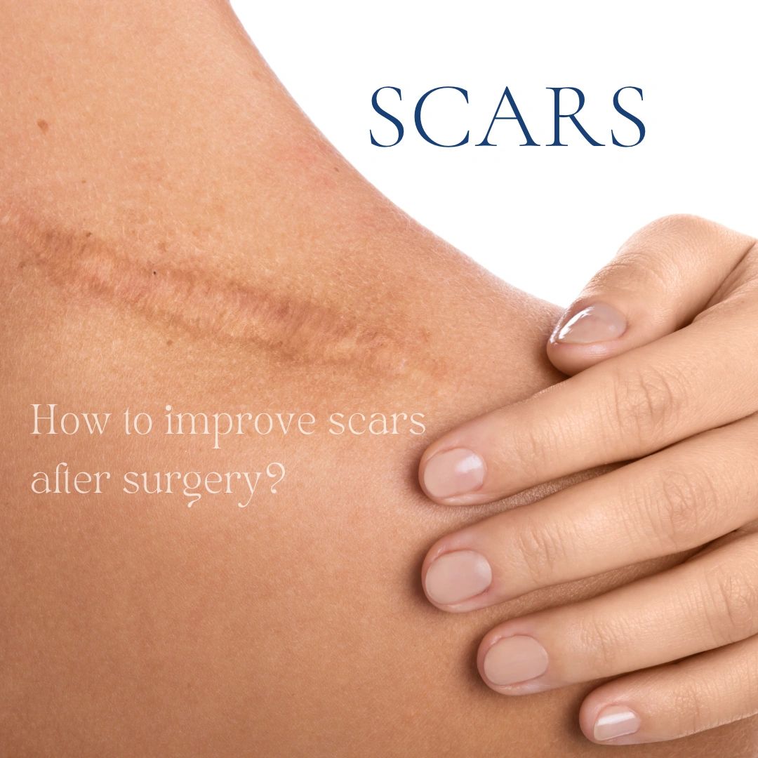 How to improve scar after surgery?