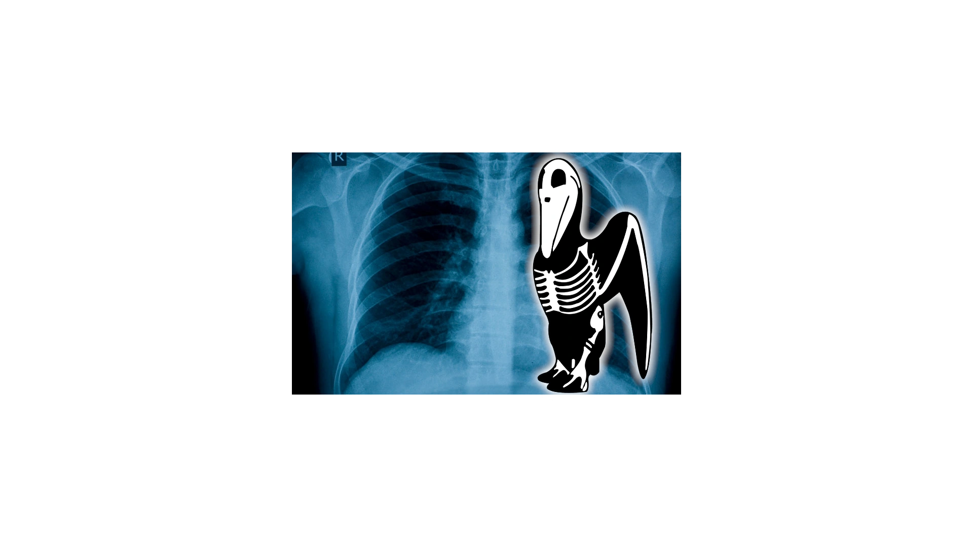 Laborde Diagnostics - NIOSH Certified B Reader