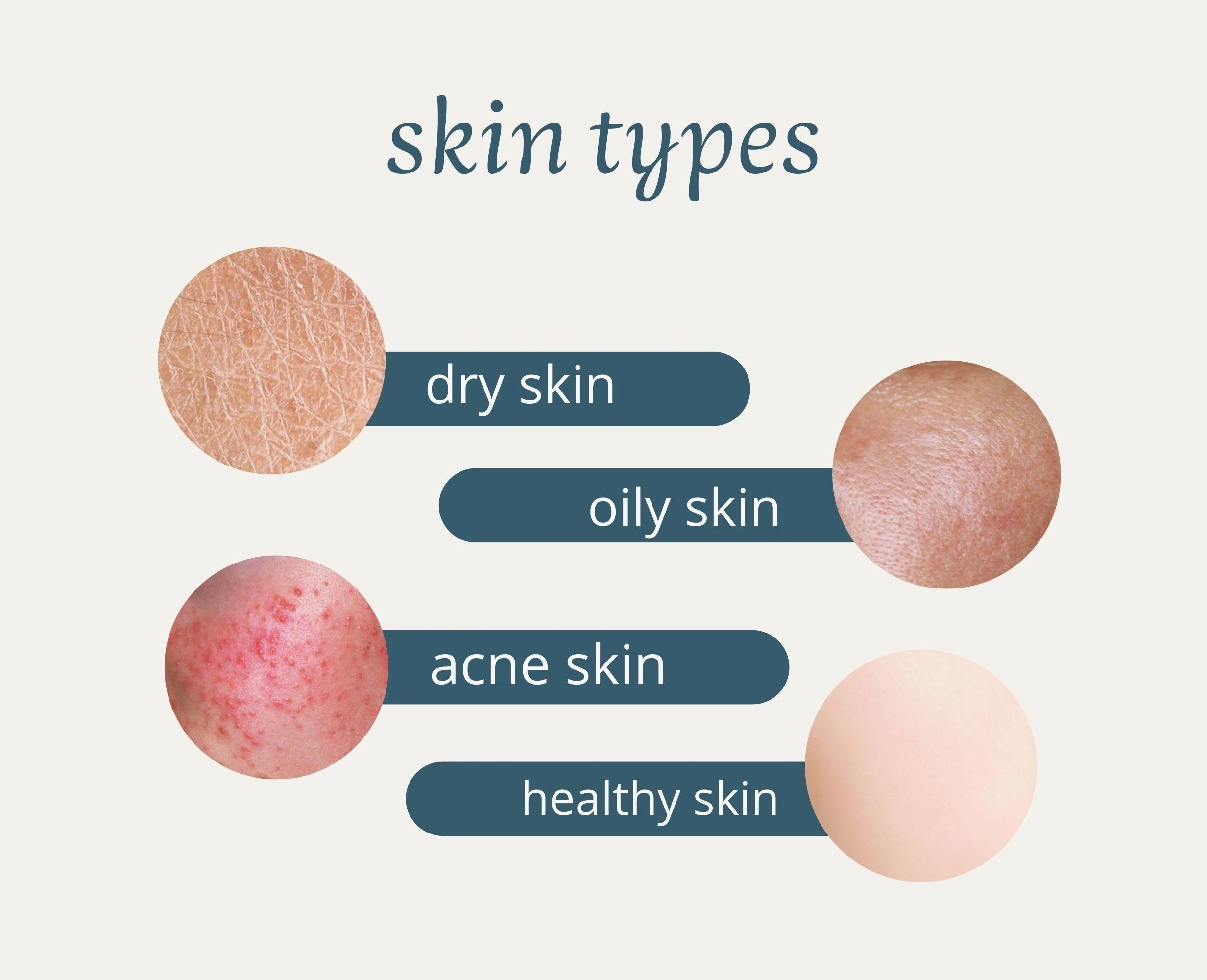 Understanding Skin Types