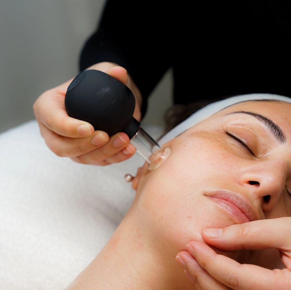 How Does Facial Cupping Work?