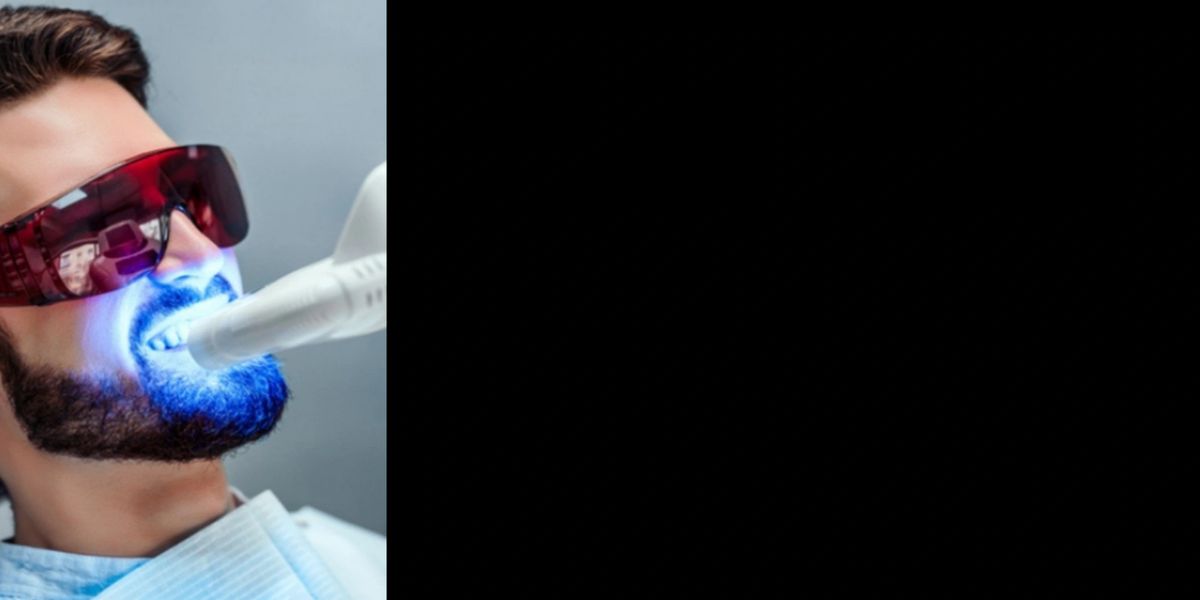 CHAIRSIDE TEETH WHITENING GELS