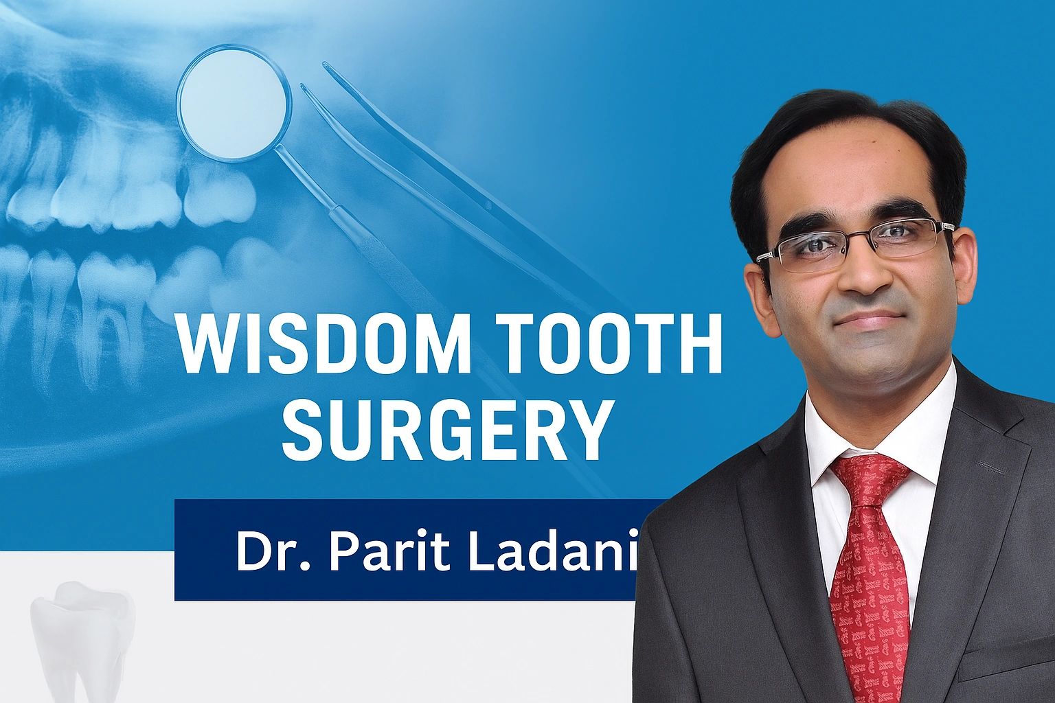 Wisdom Tooth Surgery in Andheri & Mumbai – Complete Guide