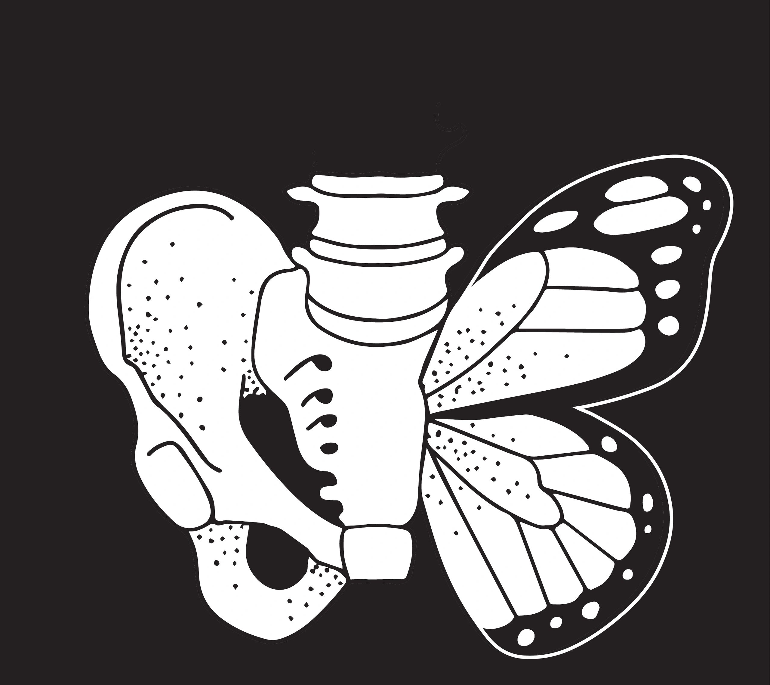 Cervicogenic Headaches | Monarch Mobile Physical Therapy LLC