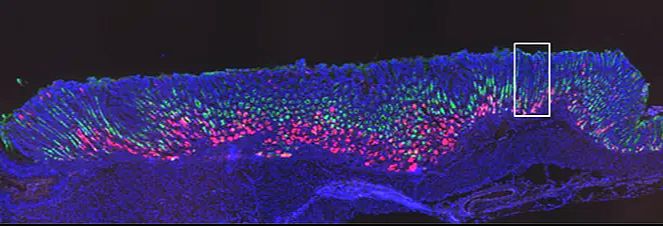 Timothy C Wang Laboratory - Lab, Research