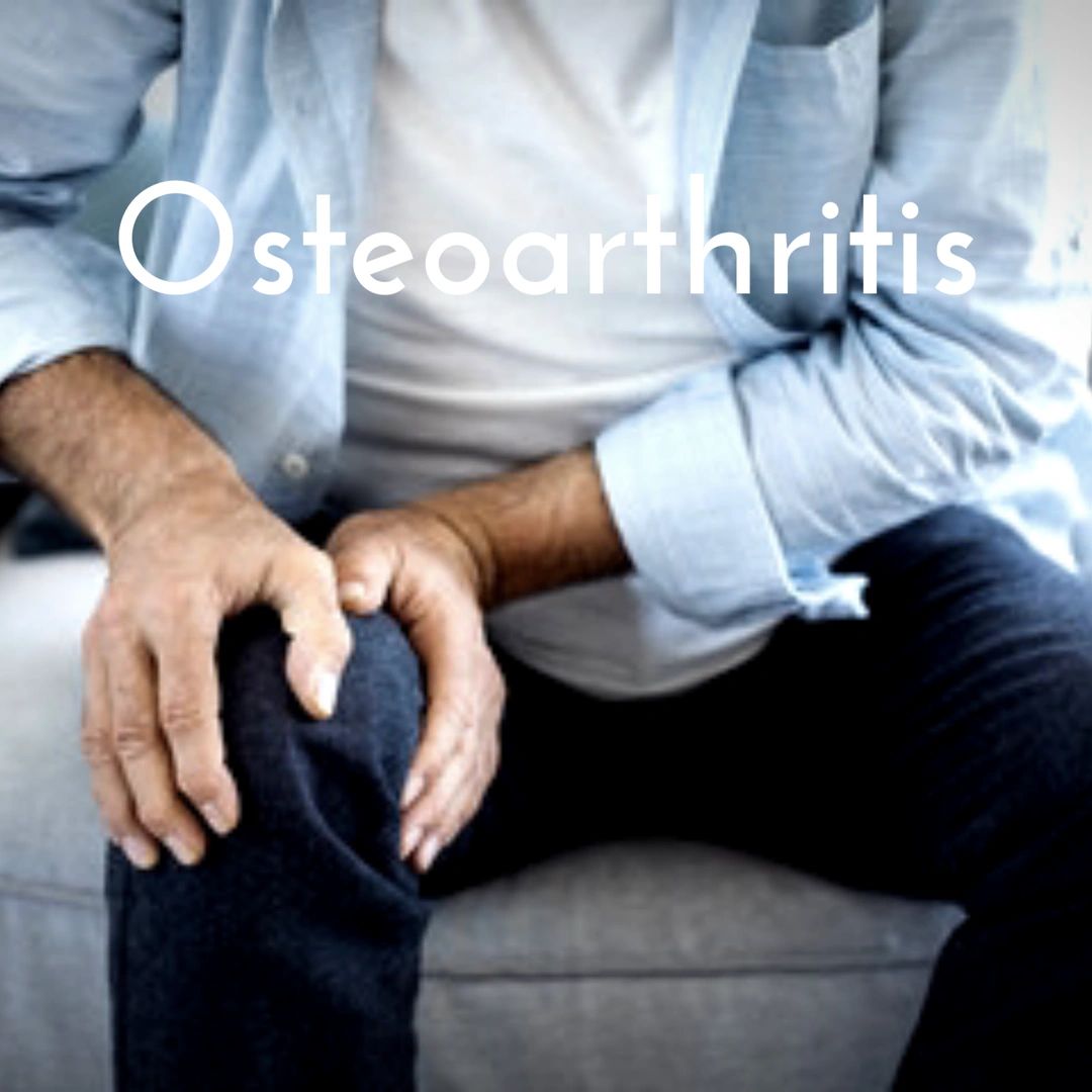Osteoarthritis (OA) of the Knee