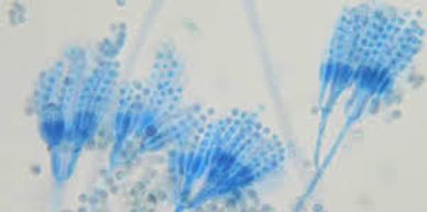 Verify Air Quality Testing - Mold Library, Common Indoor Mold, Mold ...