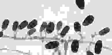 Verify Air Quality Testing - Mold Library, Common Indoor Mold, Mold ...