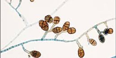 Verify Air Quality Testing - Mold Library, Common Indoor Mold, Mold ...