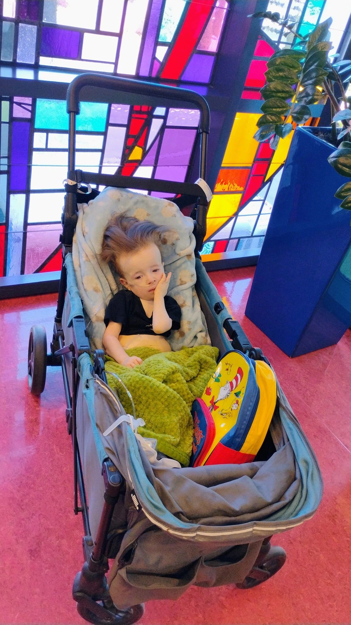 Menkes Disease, A Rare Genetic Disorder