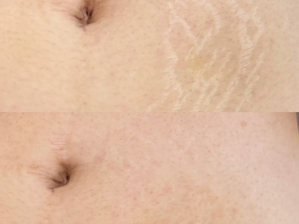 Renue Advanced Paramedical Cosmetics