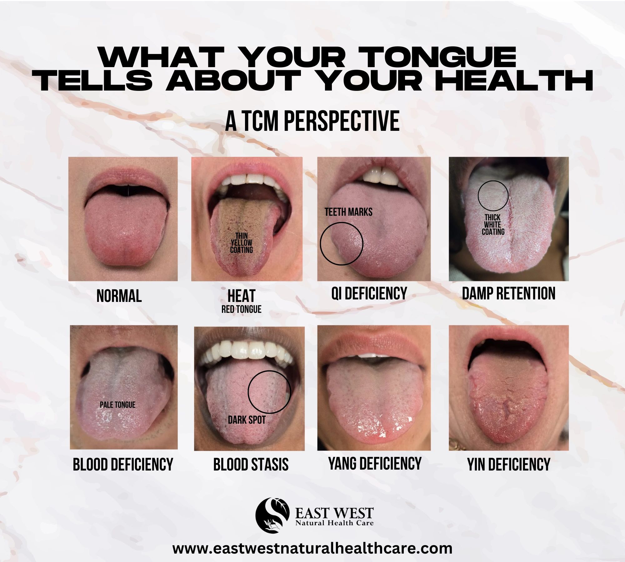What Your Tongue Tells About Your Health: A TCM Perspective