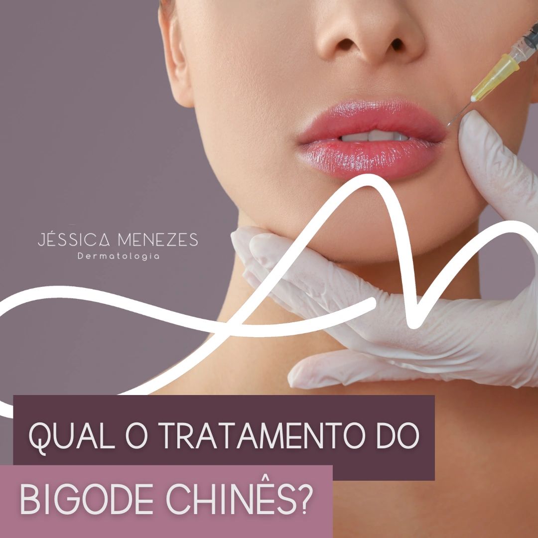 Qual o tratamento do bigode chinês?