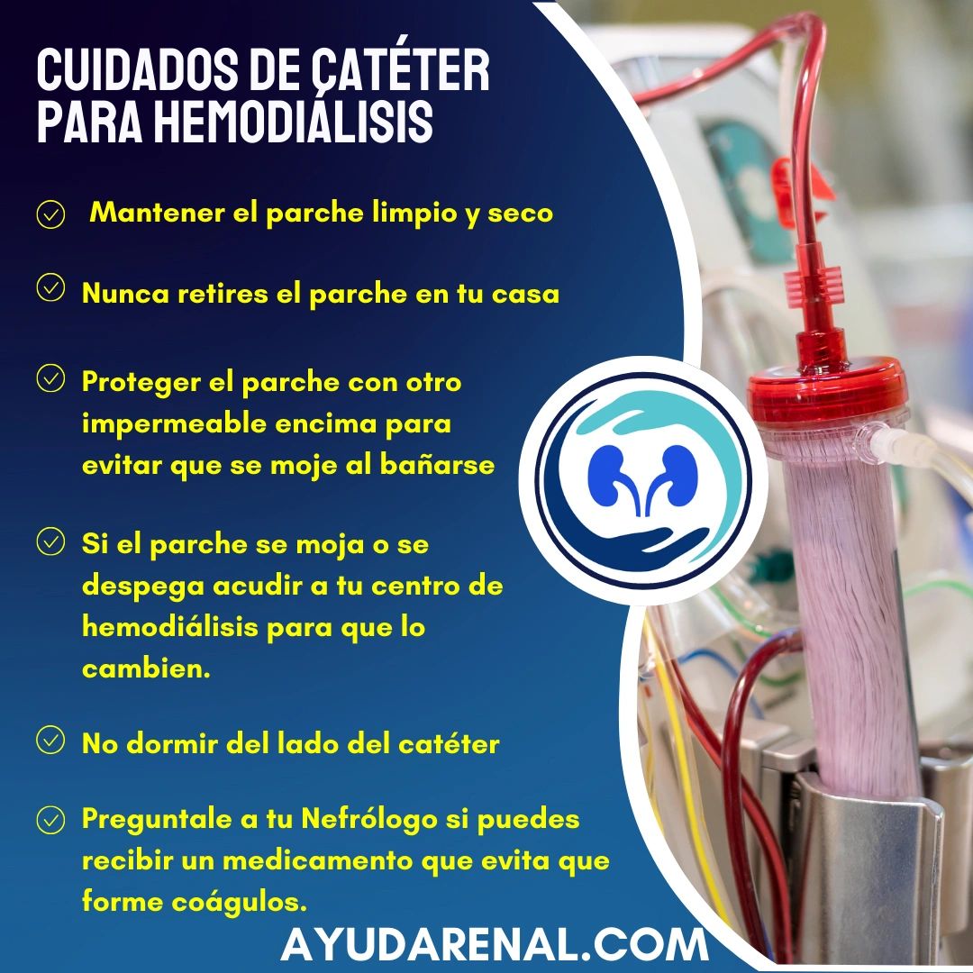Cuidados para tu catéter para hemodiálisis